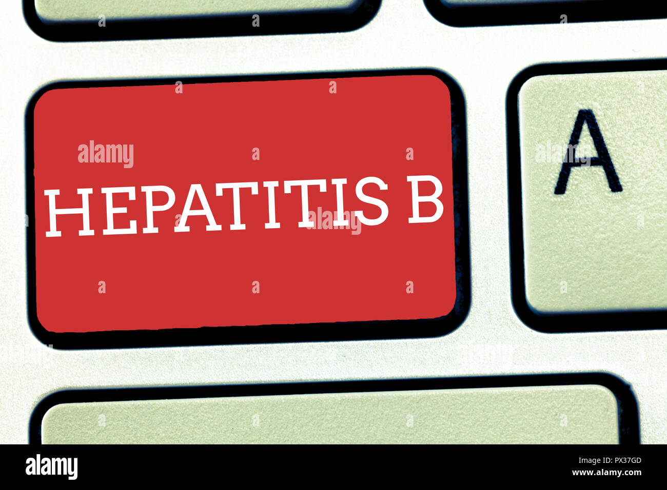 Text sign showing Hepatitis B. Conceptual photo Severe form of viral ...