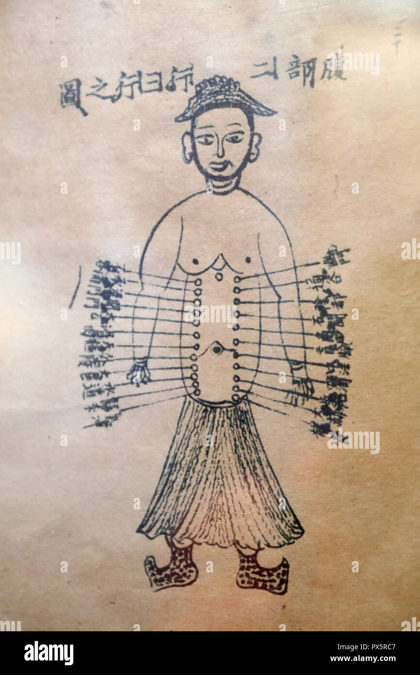 Acupuncture drawing hi-res stock photography and images - Alamy