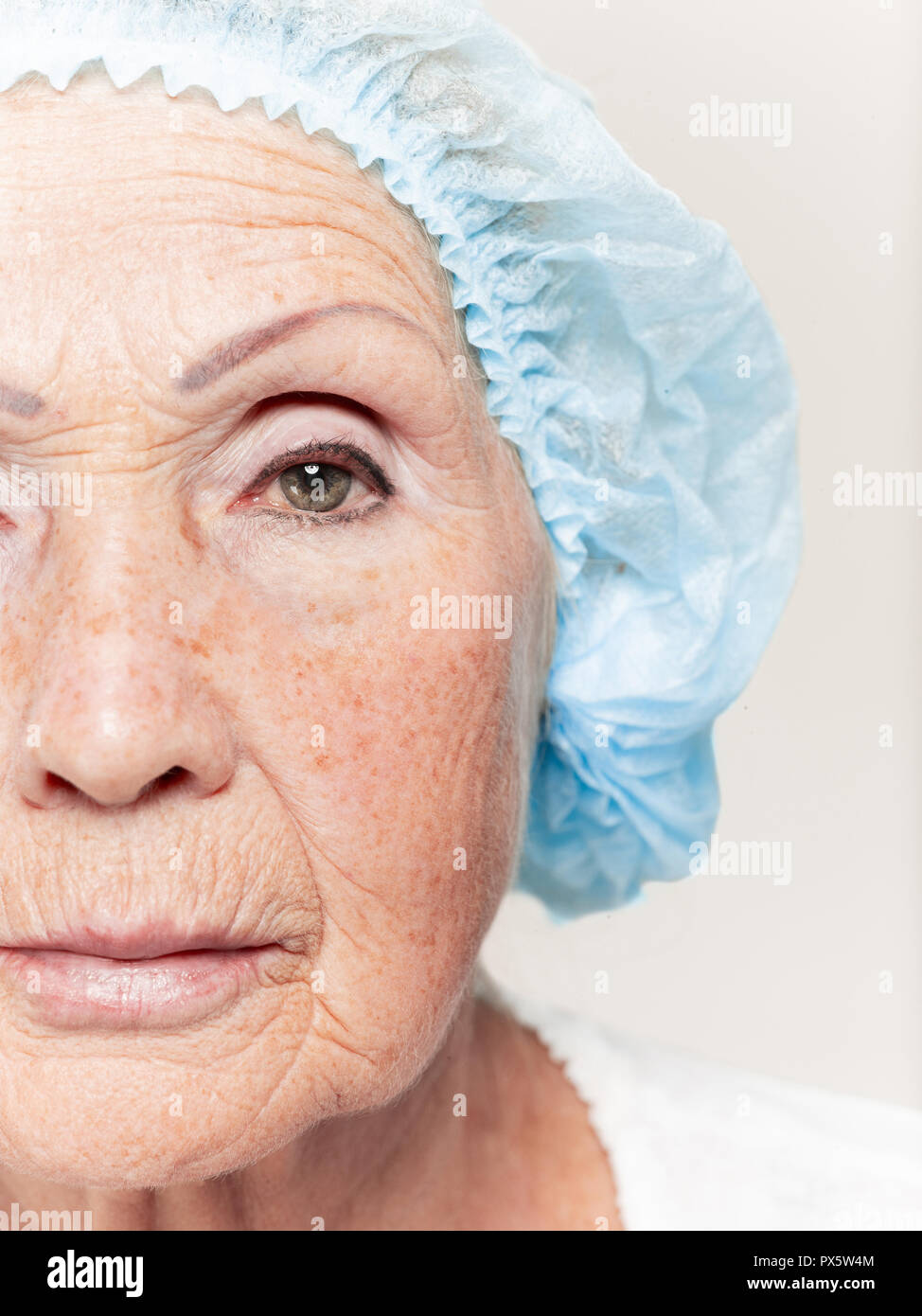 The face of mid age woman before plastic surgery. Senior female model ...