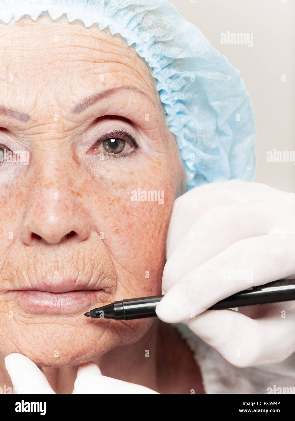 The surgeon doing skin check on mid age woman before plastic surgery ...