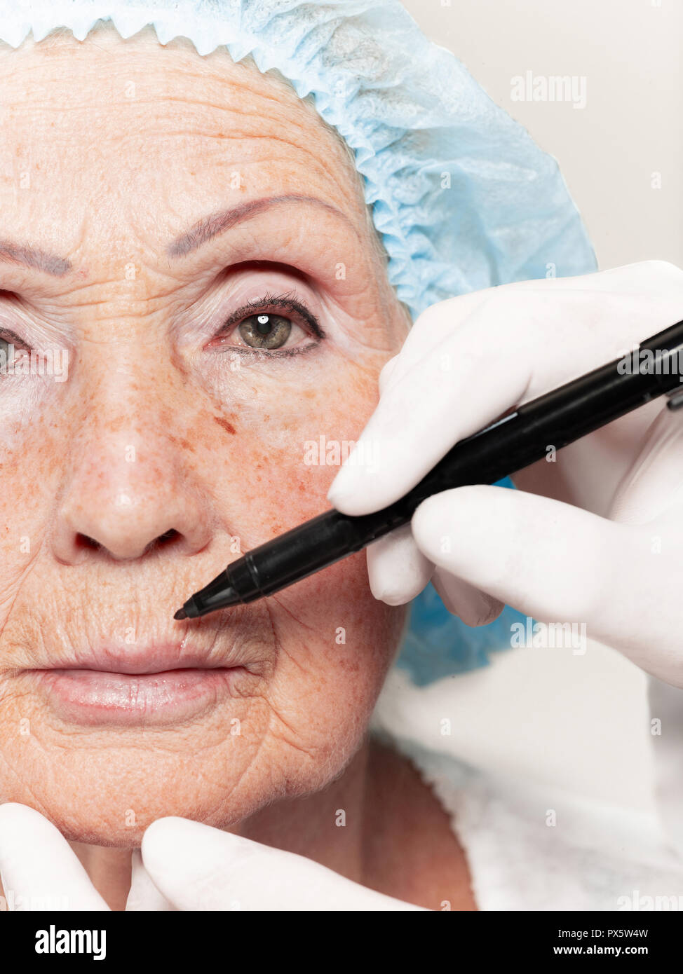 The surgeon doing skin check on mid age woman before plastic surgery ...