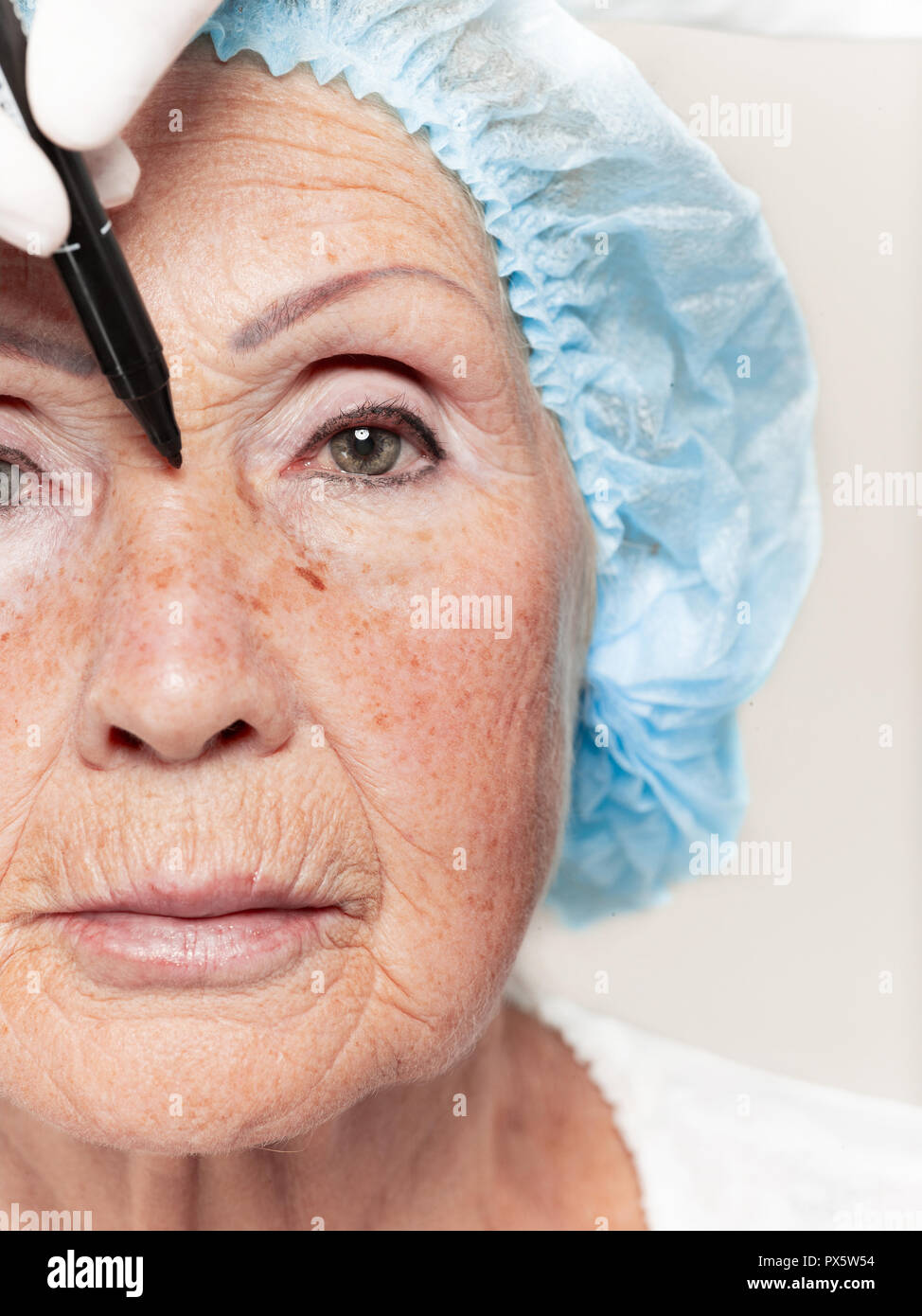 The surgeon doing skin check on mid age woman before plastic surgery ...