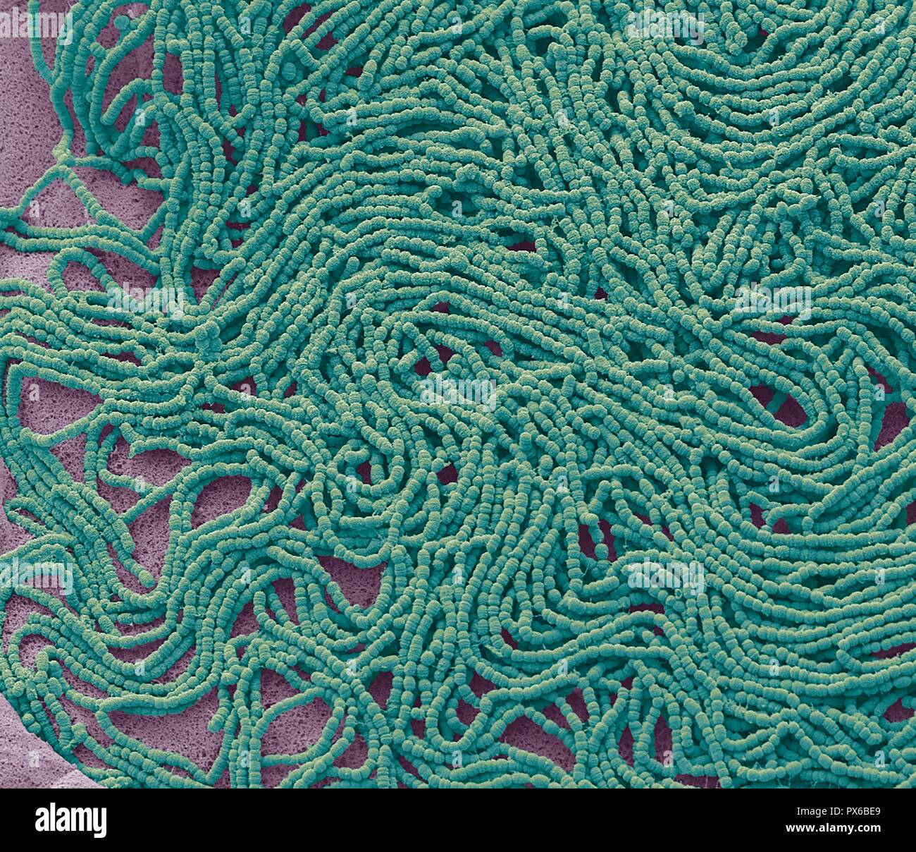 Sputum. Scanning electron micrograph (SEM) of a bacterial culture from ...