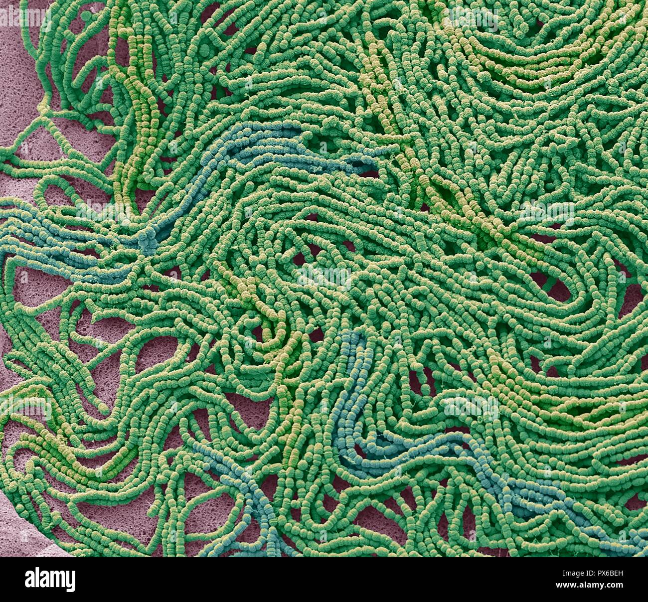 Sputum. Scanning electron micrograph (SEM) of a bacterial culture from ... Sputum. Scanning electron micrograph (SEM) of a bacterial culture from ...