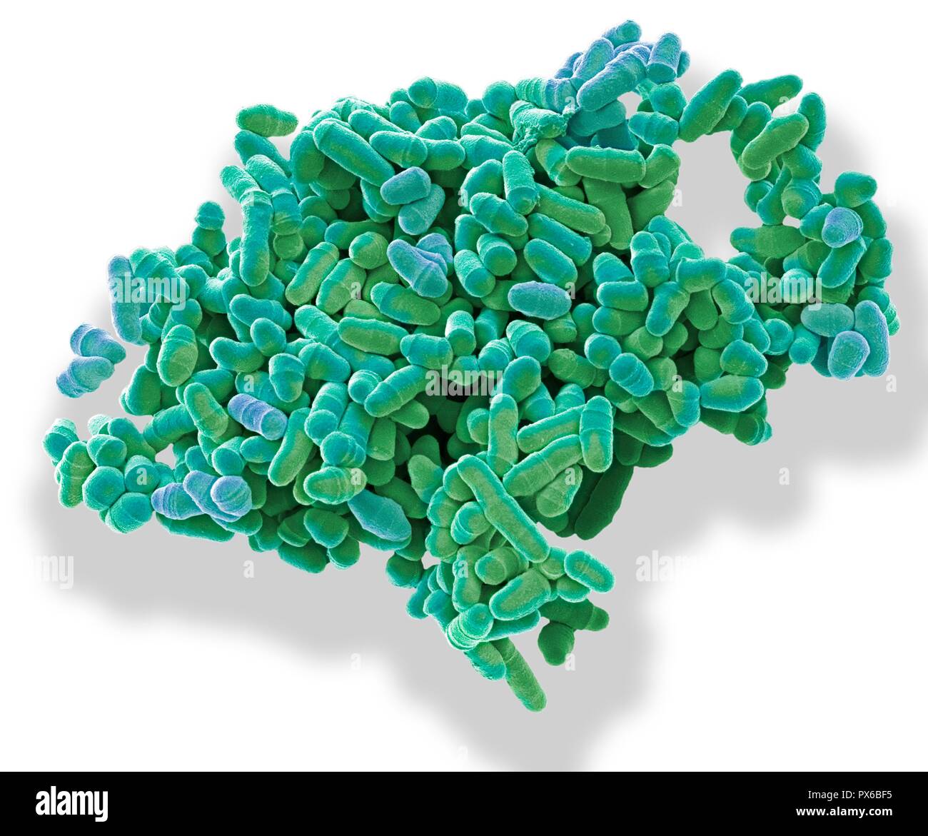 Dividing yeast cells. Coloured scanning electron micrograph (SEM) of ...