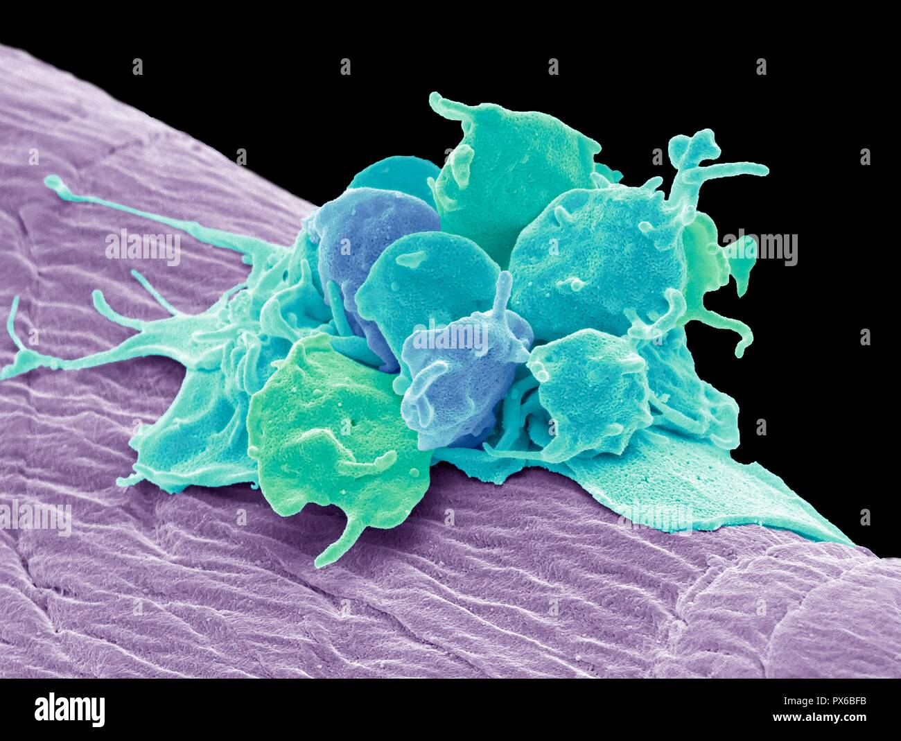 Activated platelets. Coloured scanning electron micrograph (SEM) of activated platelets attached ...