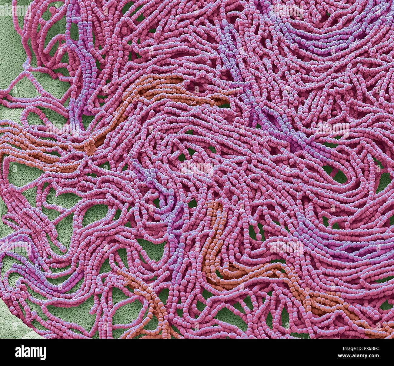 Mycobacterium Tuberculosis Microscope High Resolution Stock Photography ...