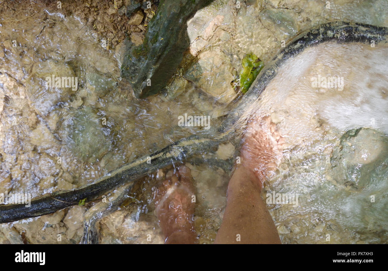 Swollen and wounded human foot immersed in clear water, Natural and ...