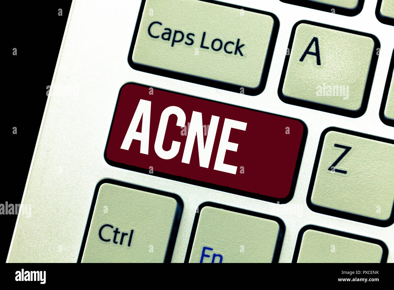 Word writing text Acne. Business concept for Skin disease involving the ...