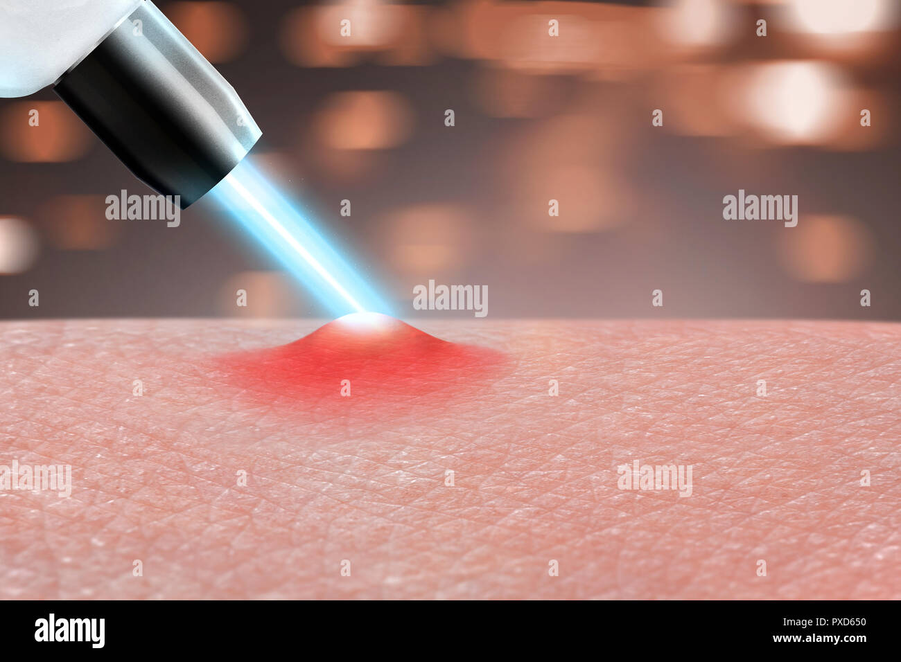 Removal body parts hi-res stock photography and images - Alamy