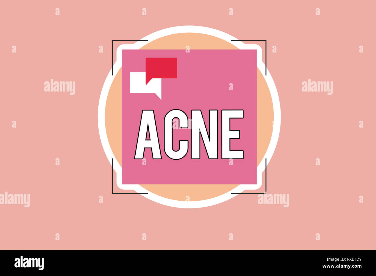 Writing note showing Acne. Business photo showcasing Skin disease ...