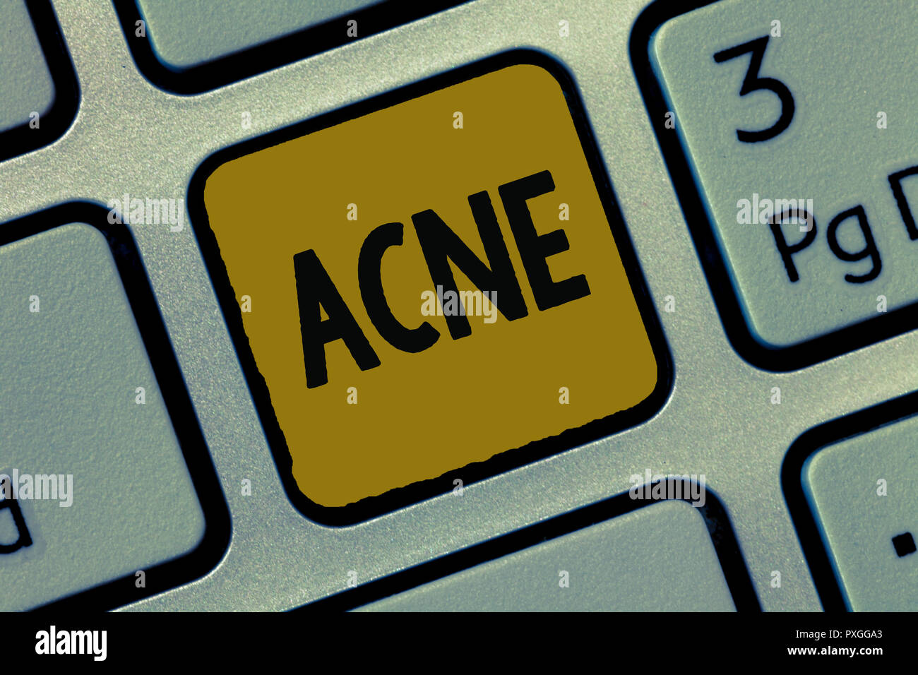 Text sign showing Acne. Conceptual photo Skin disease involving the oil ...