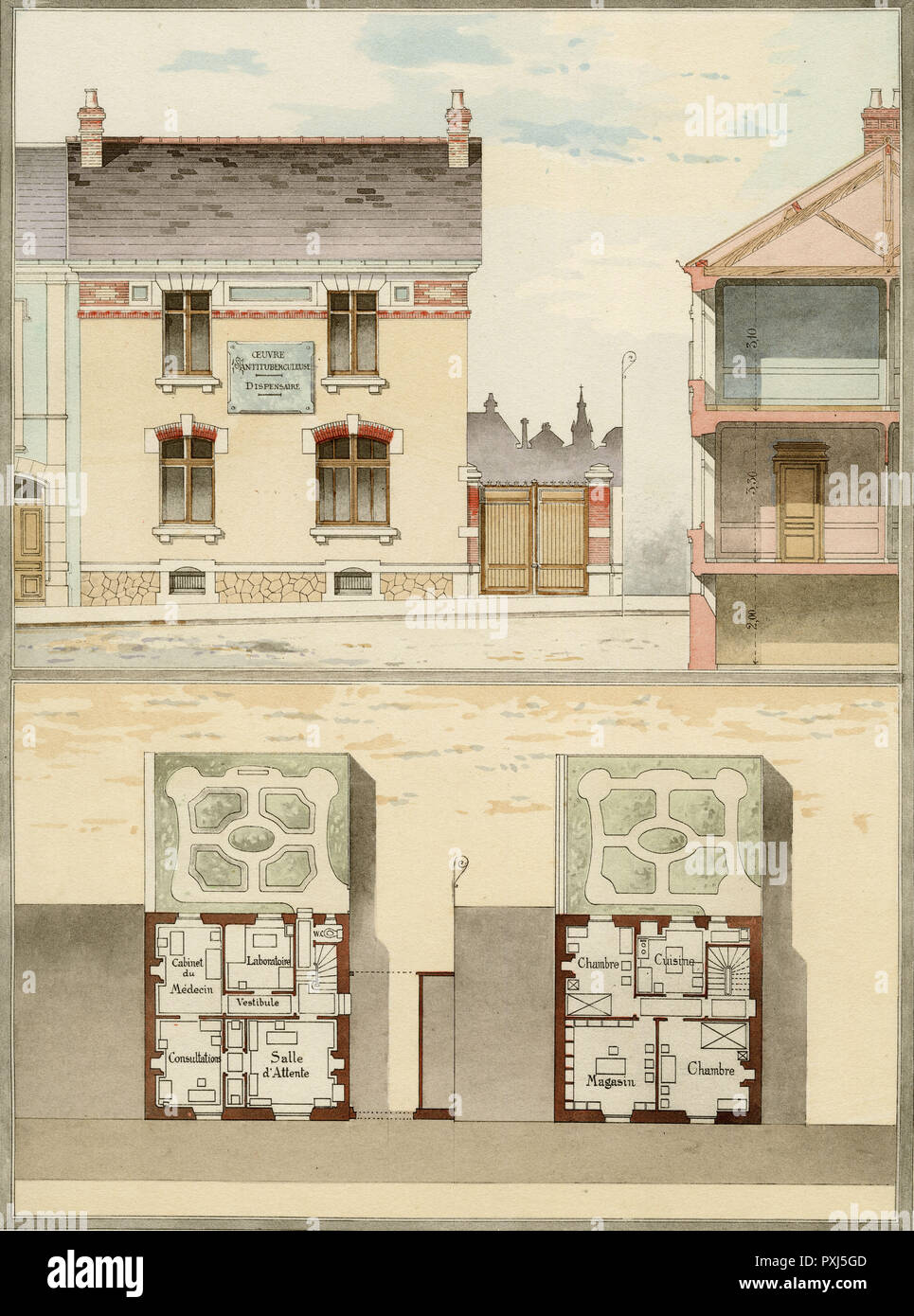 Tuberculosis interior hi-res stock photography and images - Alamy