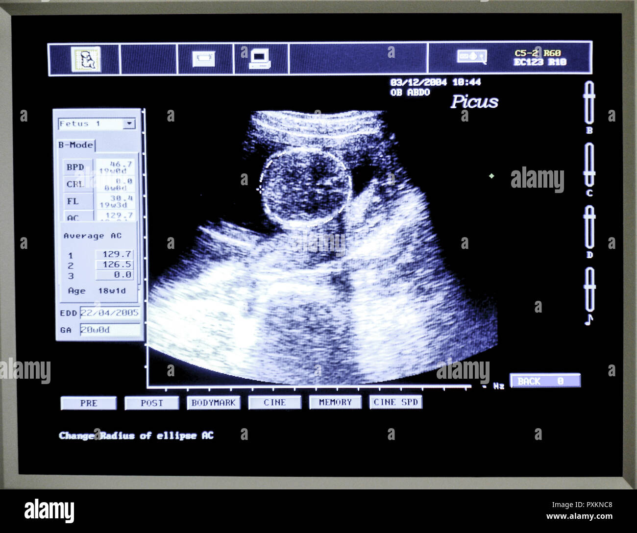 Ultrasonic testing, ultrasonic scan Stock Photo - Alamy