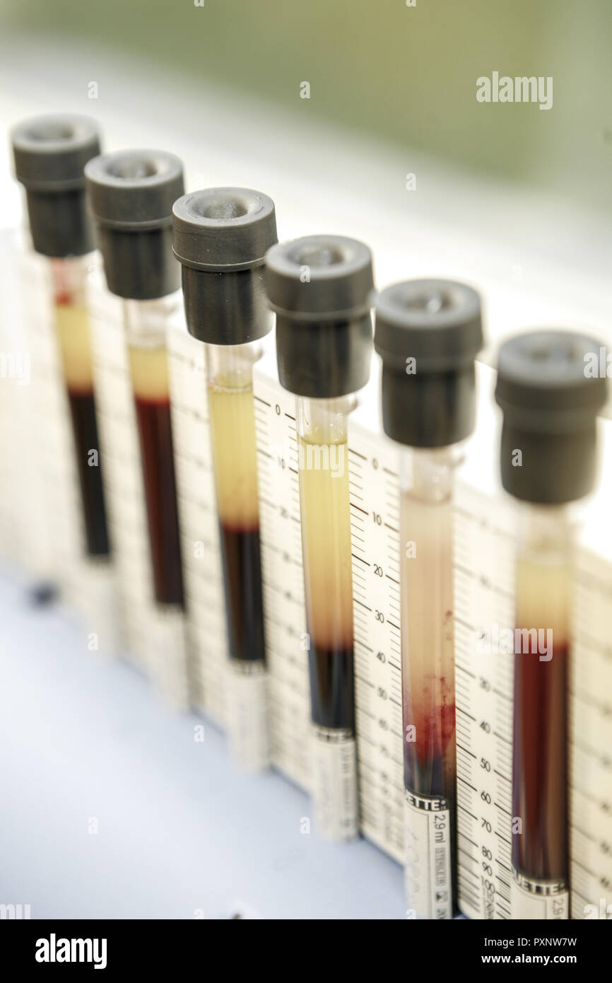 Blood samples in tubes Stock Photo - Alamy