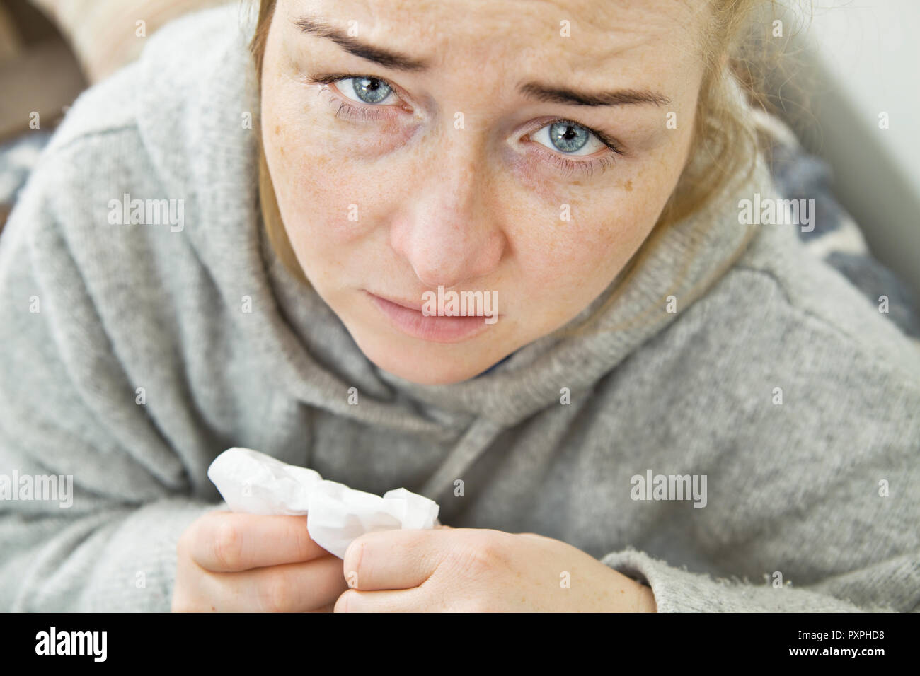 Stressed exhausted young woman having strong tension headache Stock ...