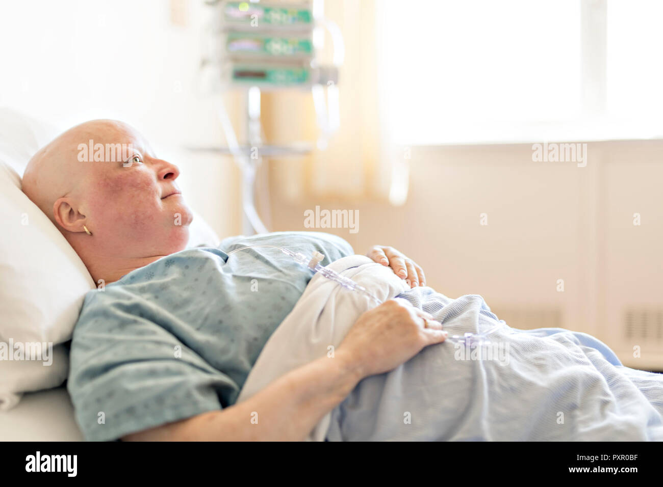 woman in hospital bed suffering from cancer Stock Photo - Alamy