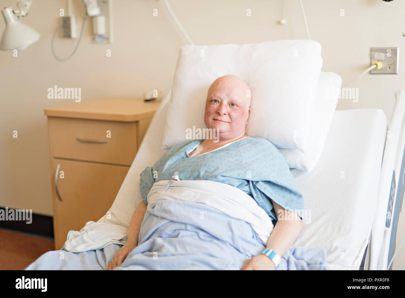 woman in hospital bed suffering from cancer Stock Photo - Alamy