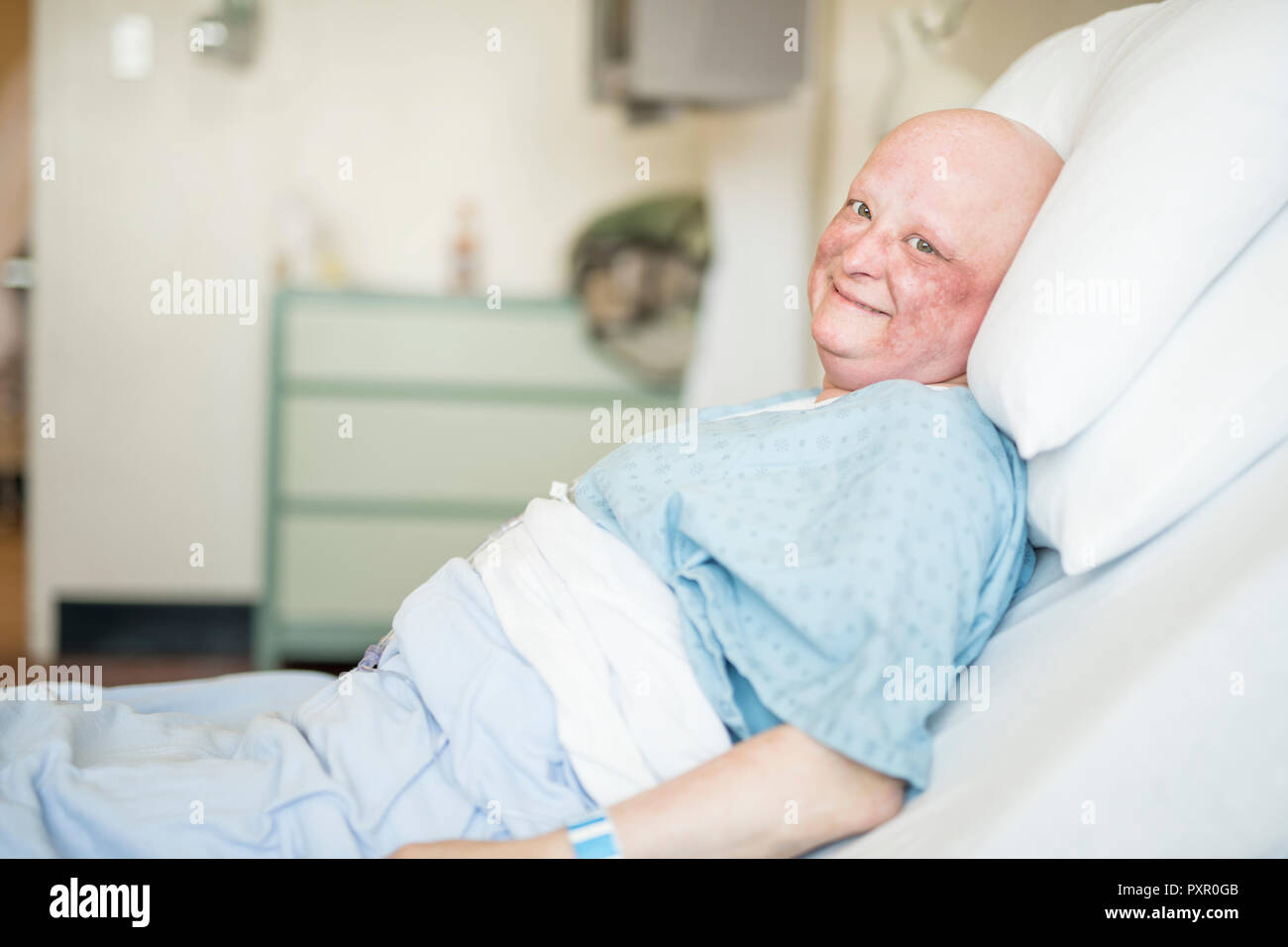 woman in hospital bed suffering from cancer Stock Photo - Alamy