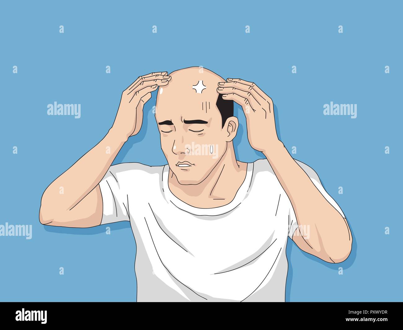 Man alopecia Stock Vector Images - Alamy