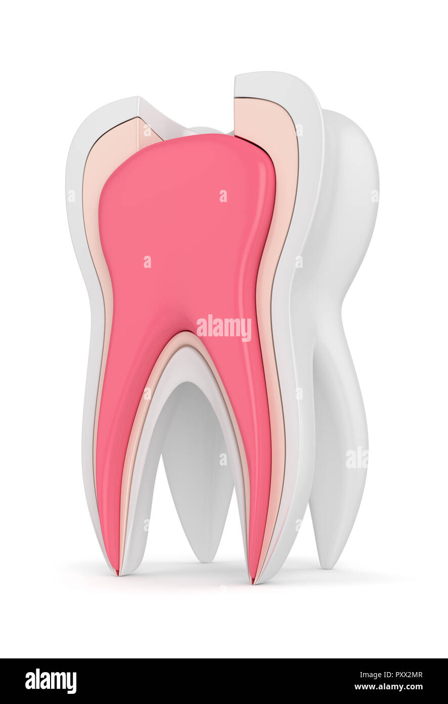 3d render of tooth with root canal treatment procedure over white ...