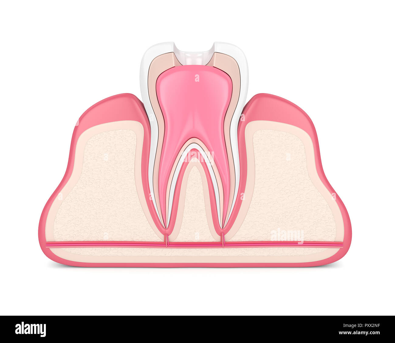 3d render of tooth in gums with root canal treatment procedure over ...