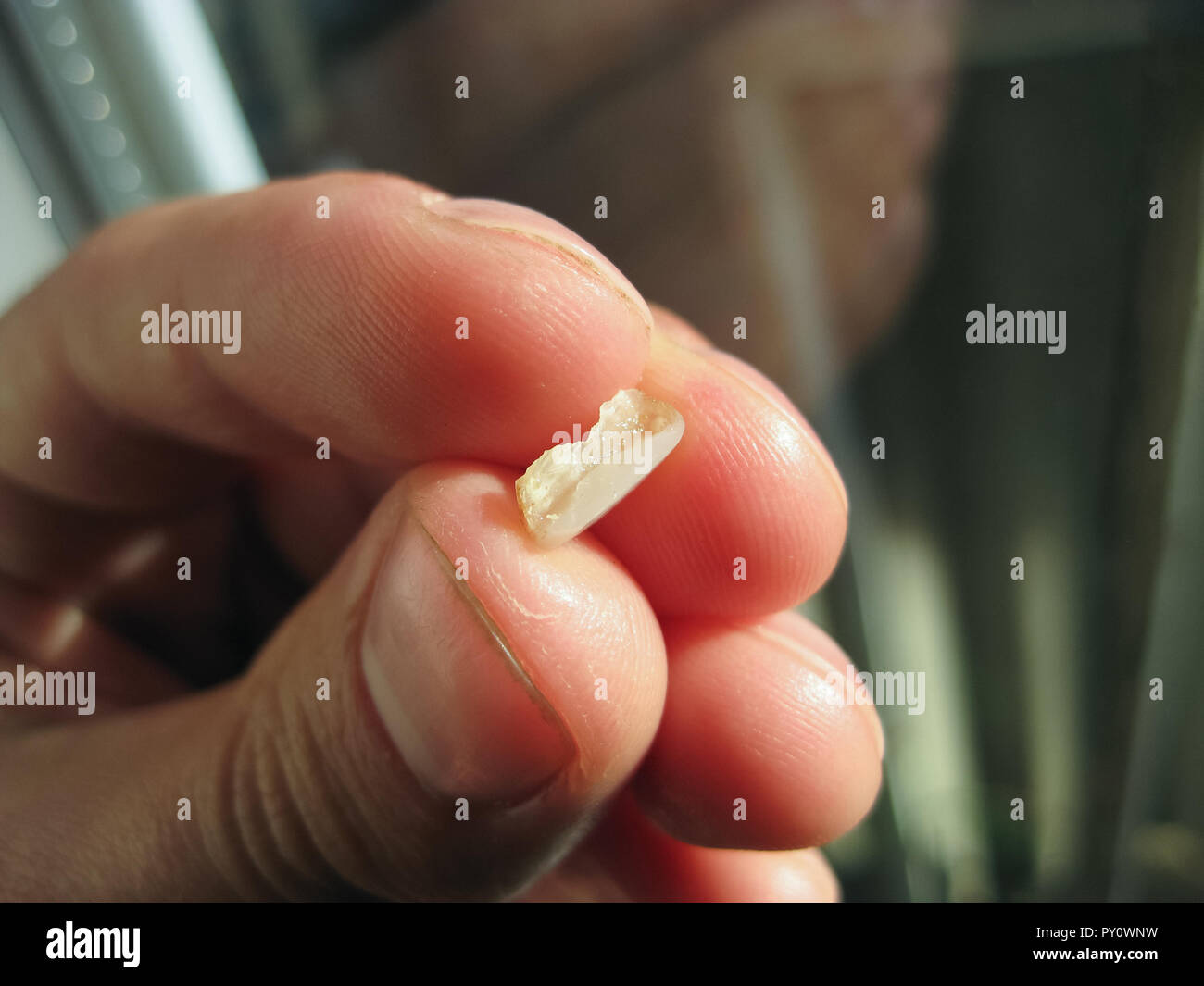Endodontic hi-res stock photography and images - Alamy