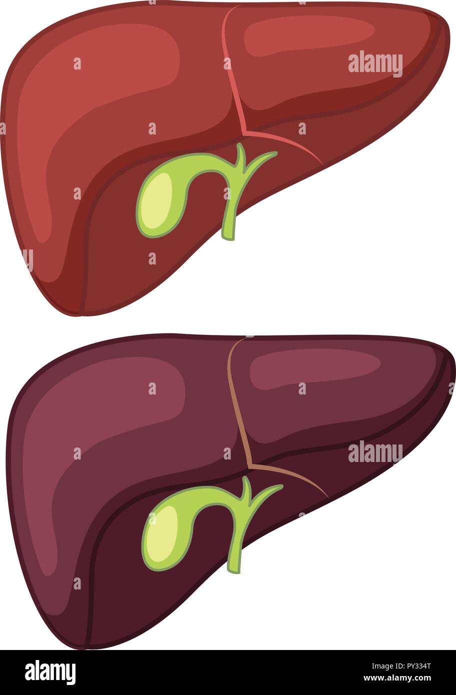 Liver cirrhosis drawing hi-res stock photography and images - Alamy