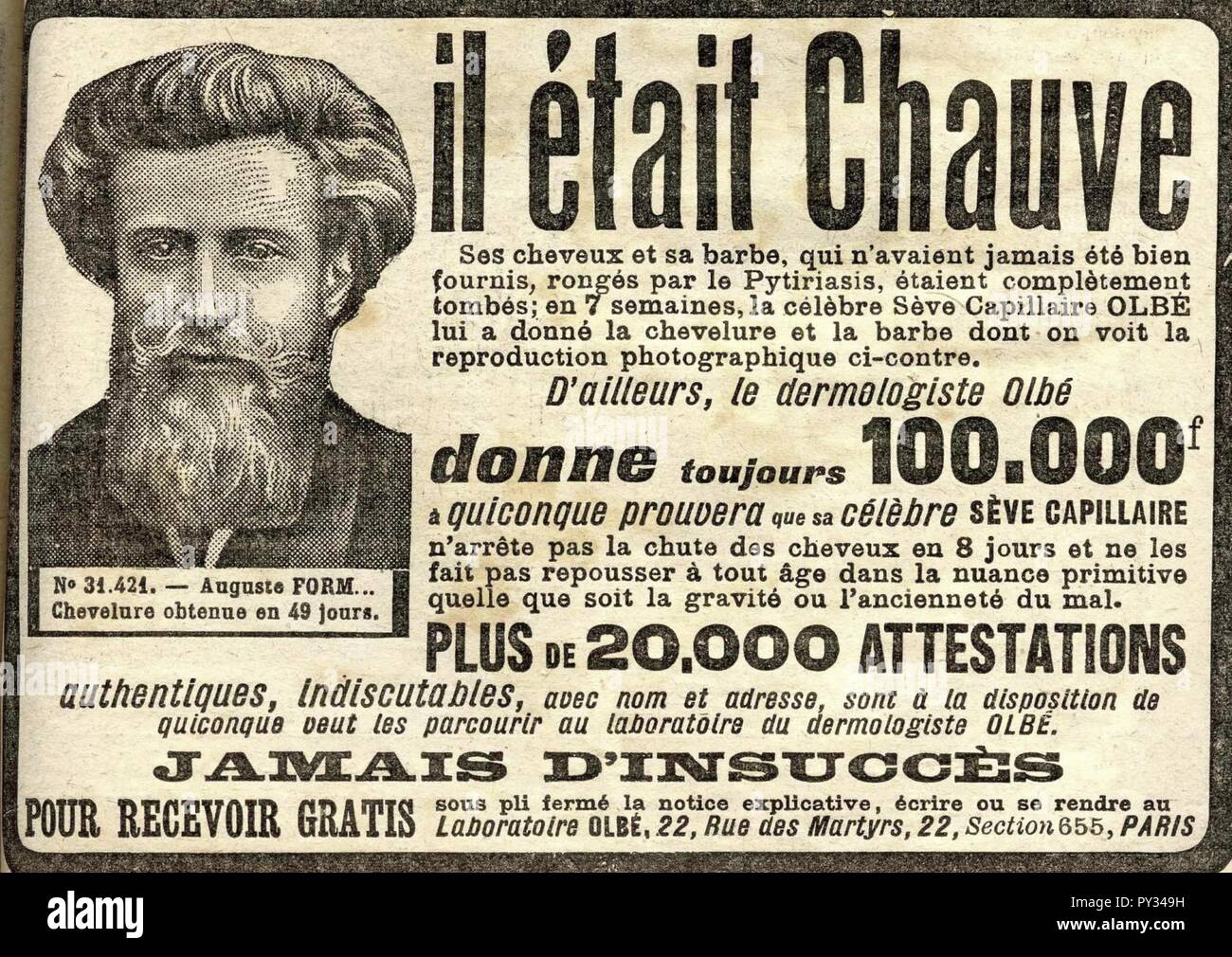 Calvitie hi-res stock photography and images - Alamy