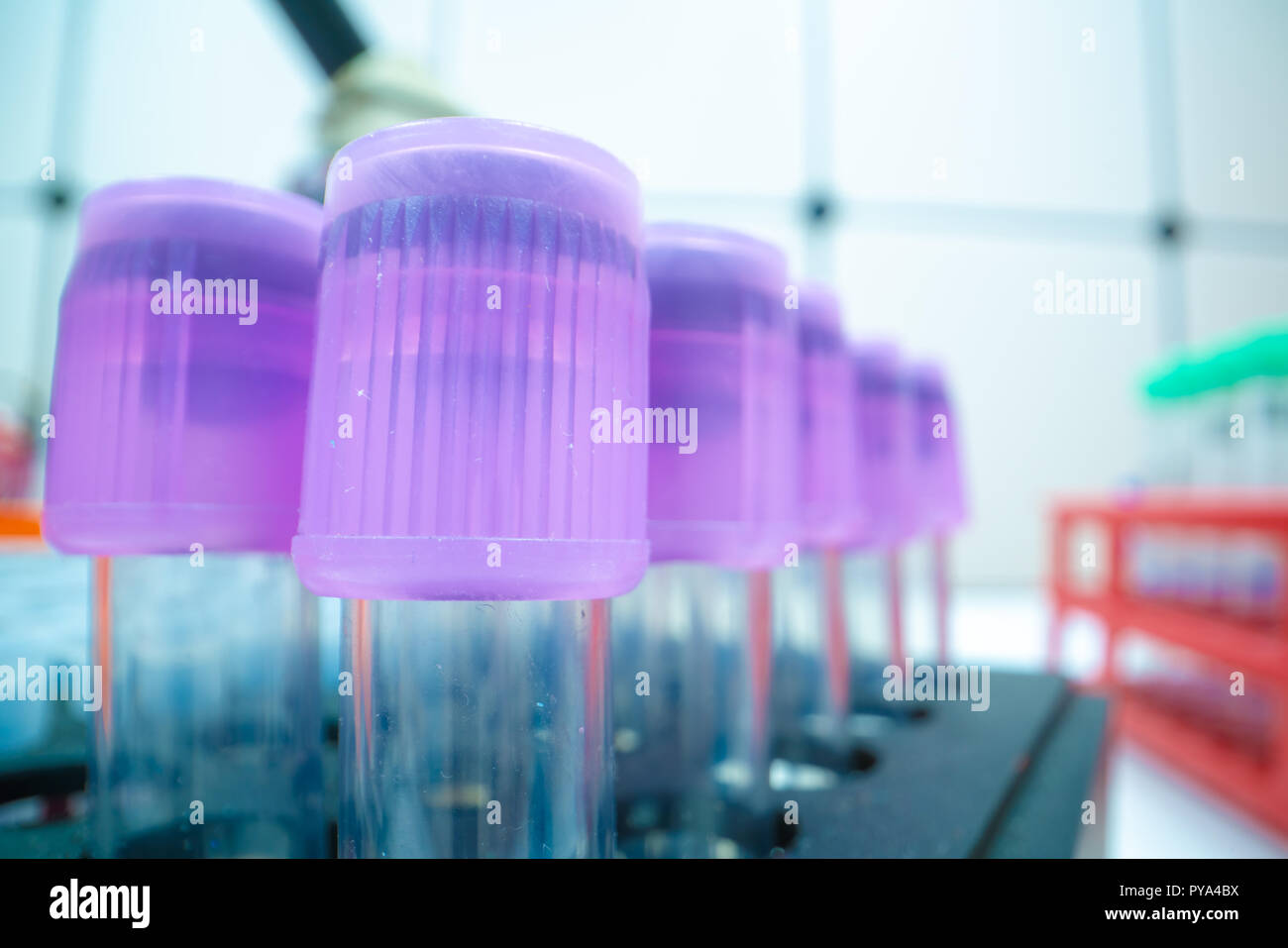 Test tubes in the medical lab. science laboratory test tubes ...