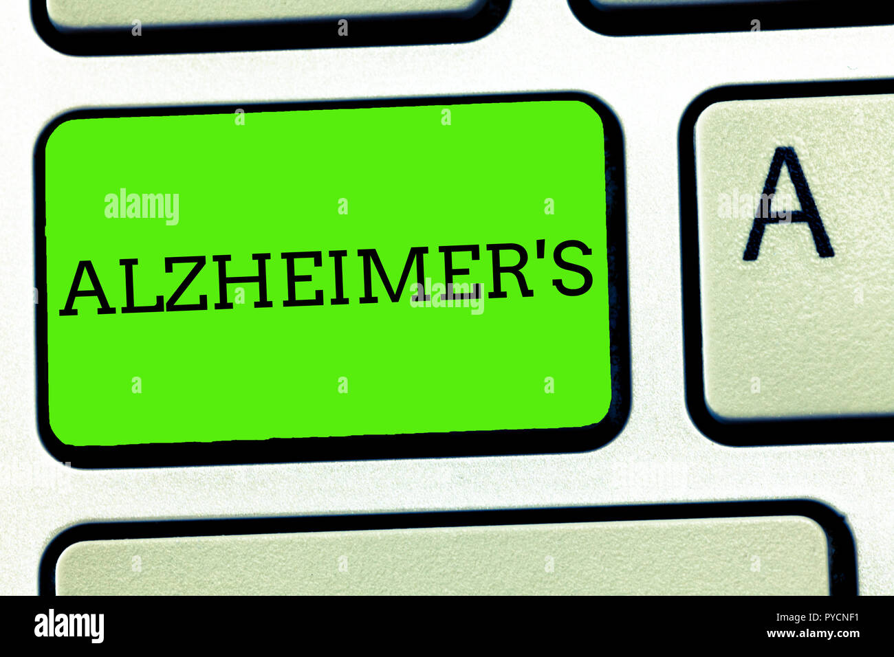 Writing note showing Alzheimer s is. Business photo showcasing ...