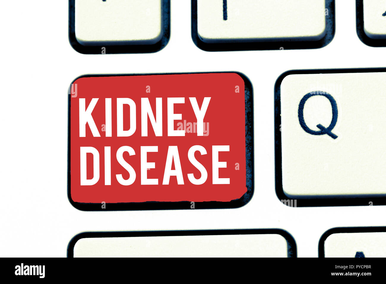 Handwriting text writing Kidney Disease. Concept meaning Kidneys can no ...