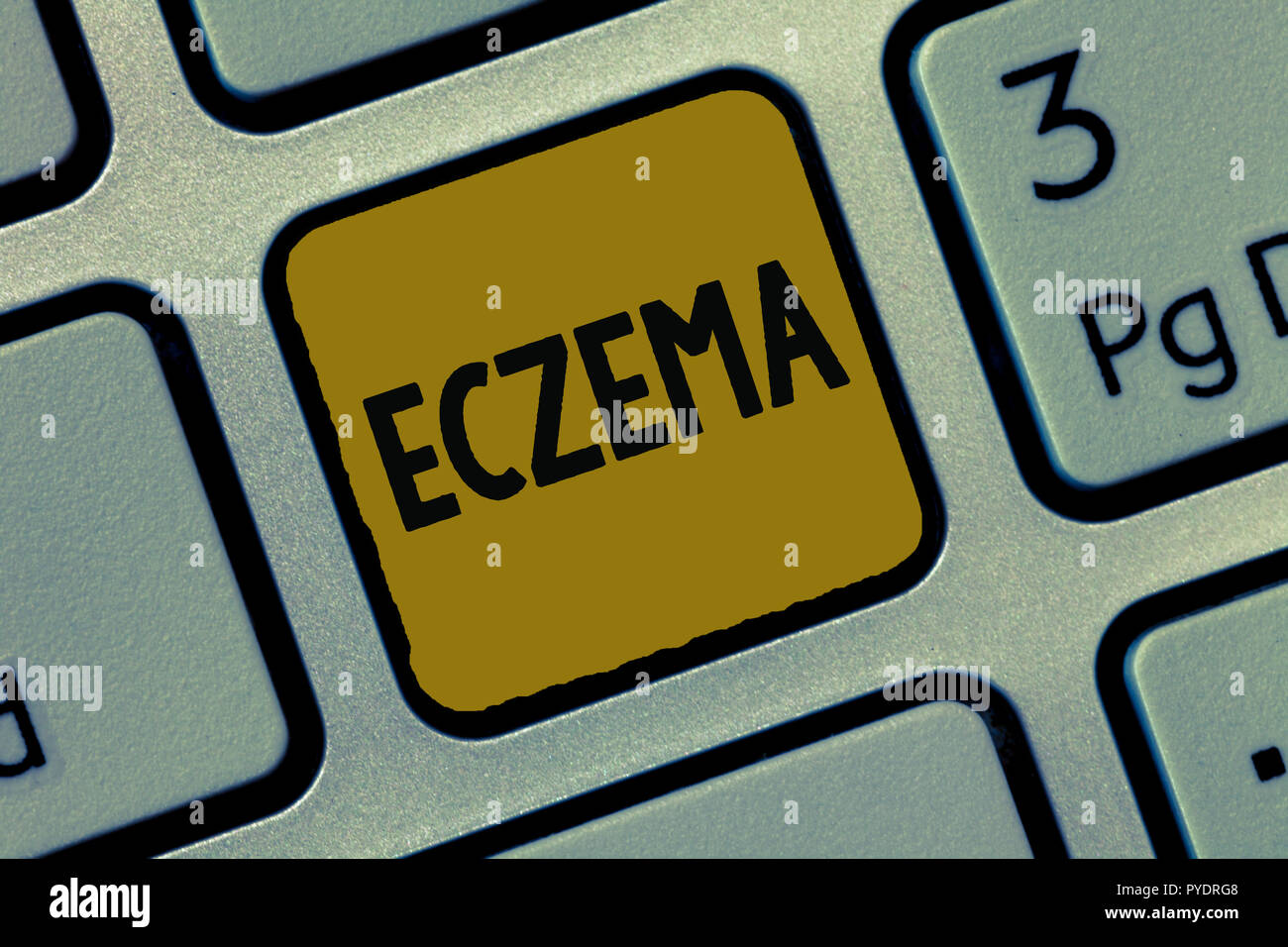 Text sign showing Eczema. Conceptual photo Skin condition marked by ...