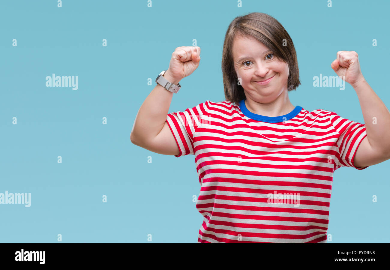 Young adult woman with down syndrome over isolated background showing ...