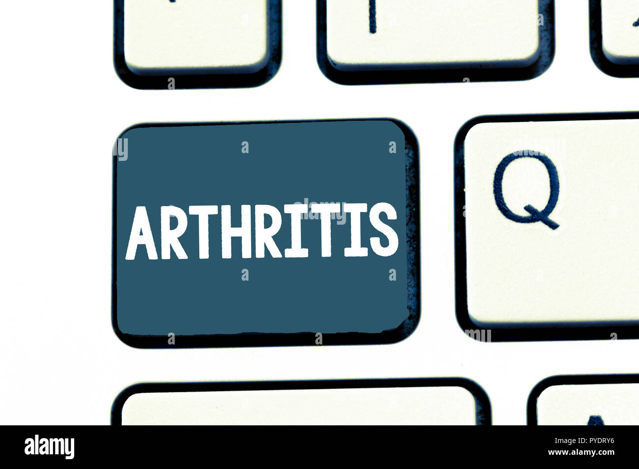 Text sign showing Arthritis. Conceptual photo Disease causing painful ...