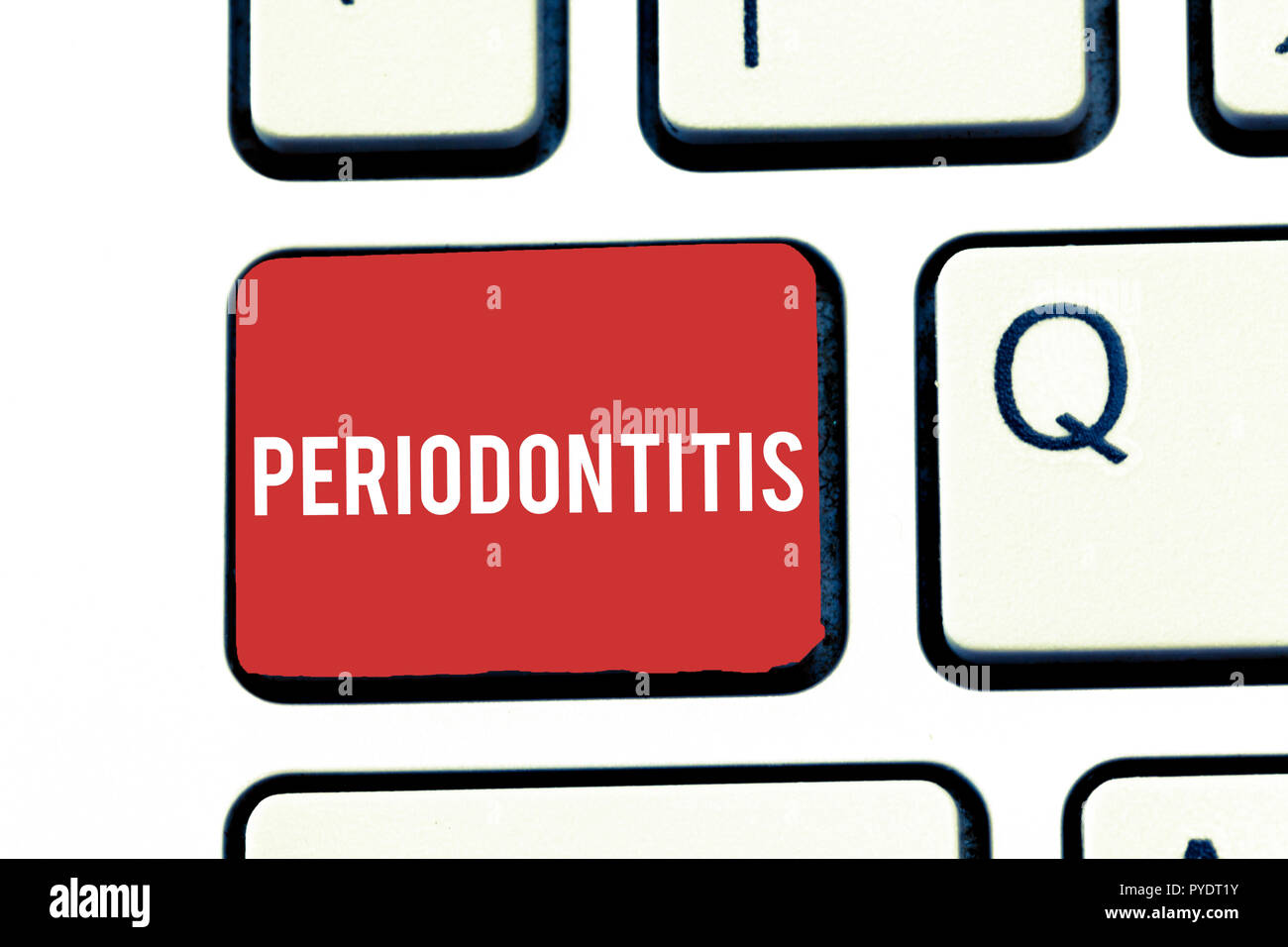 Handwriting Text Writing Periodontitis Concept Meaning Swelling Of The Tissue Around The Teeth handwriting-text-writing-periodontitis-concept-meaning-swelling-of-the-tissue-around-the-teeth