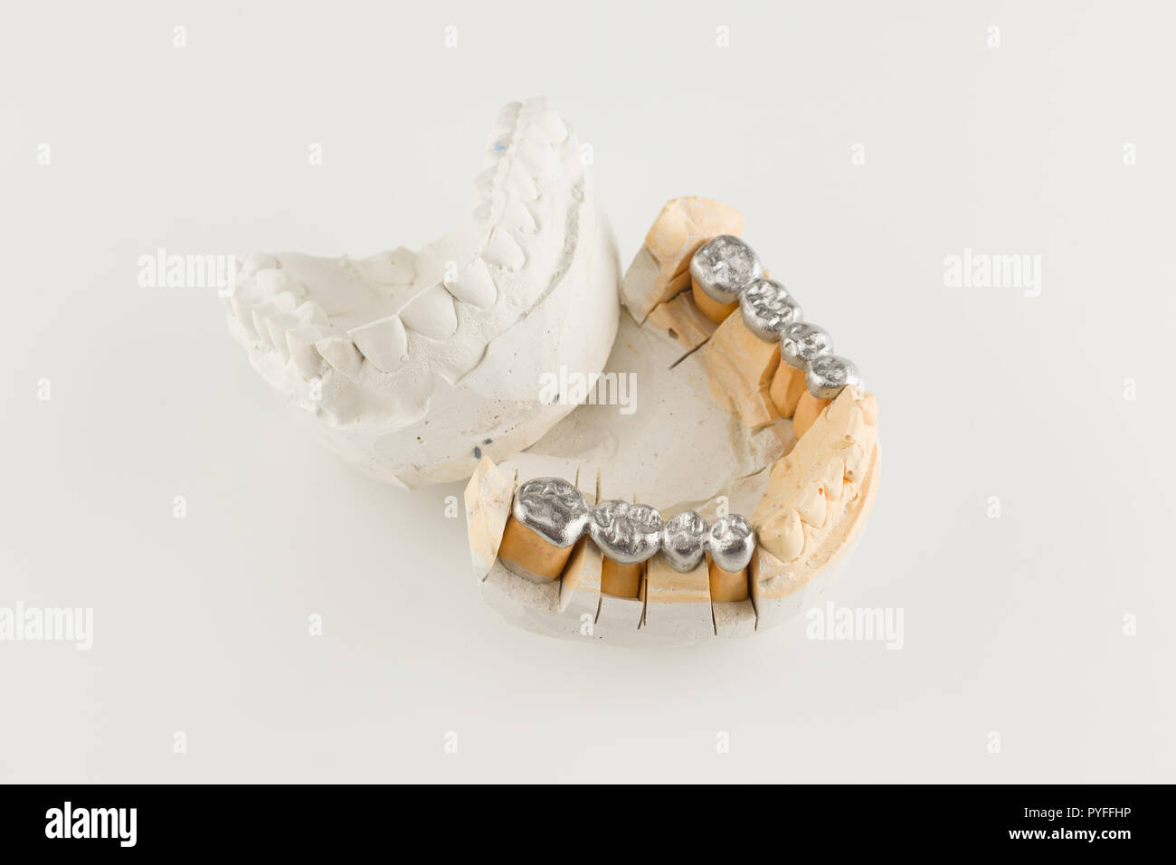 bases of metal-cast bridges on an artificial dental model Stock Photo ...