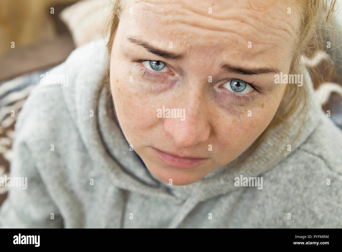 Young woman with blue eyes has headache. Health and pain Stock Photo ...