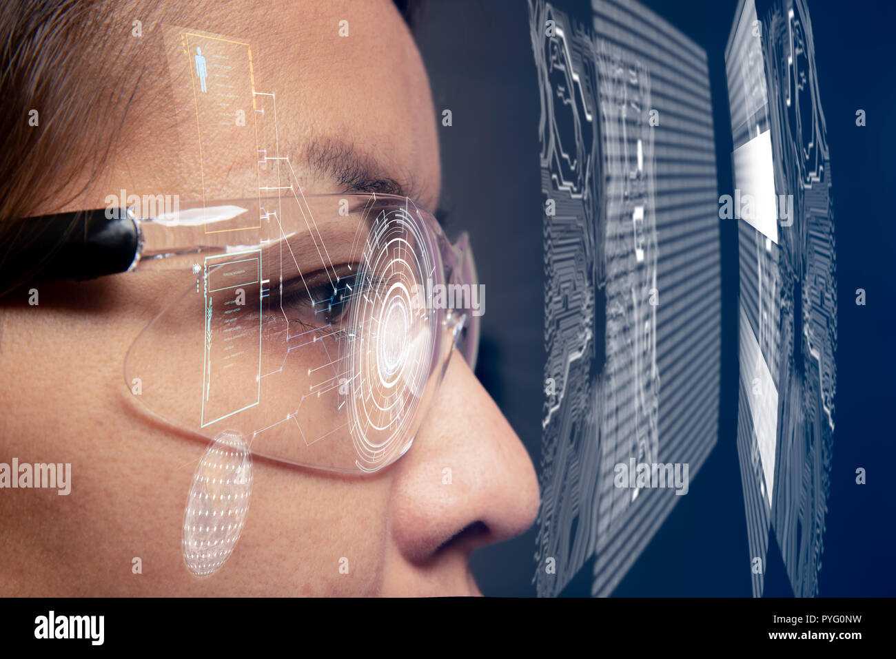 Bionic eye hi-res stock photography and images - Alamy