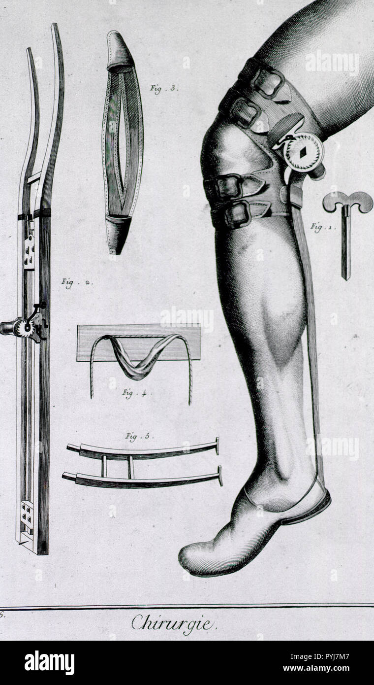 1700s Medical Instruments High Resolution Stock Photography and Images ...