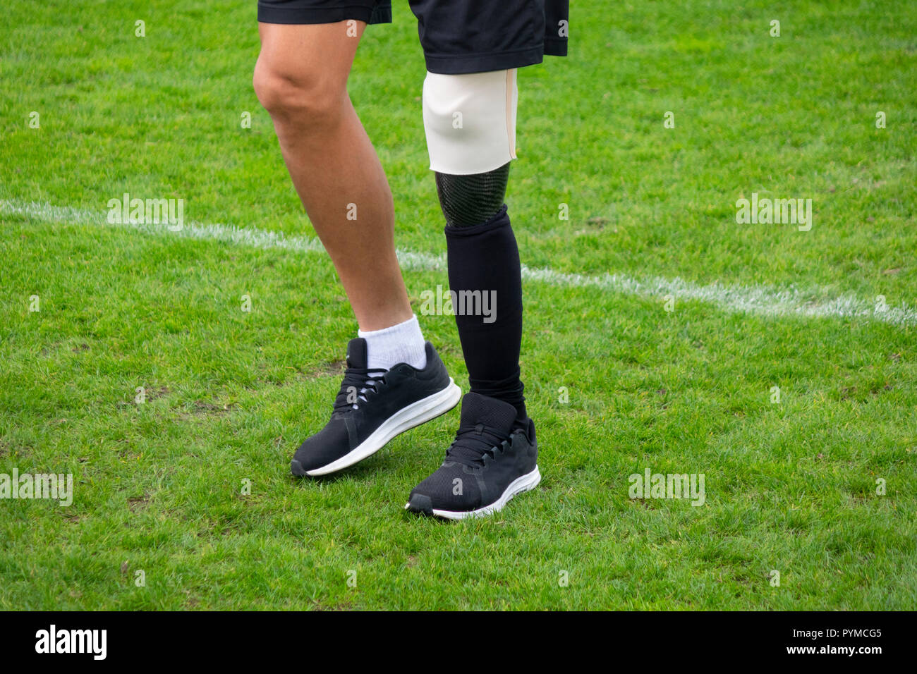 Close up disabled man athlete with leg prosthesis. Paralympic Sport ...