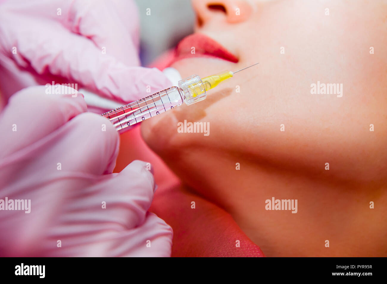 Facial injections hi-res stock photography and images - Alamy