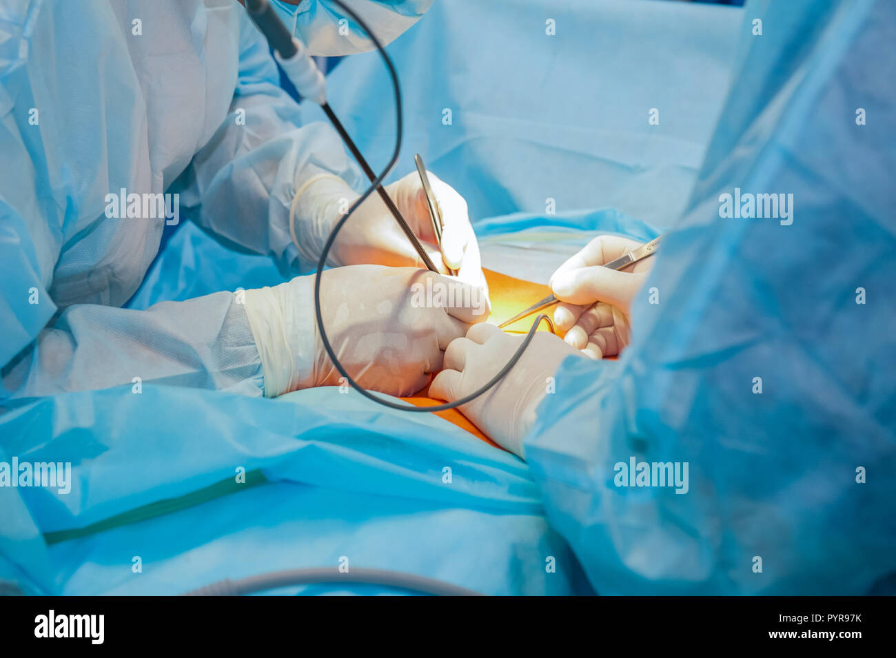 Peritoneal cavity hi-res stock photography and images - Alamy