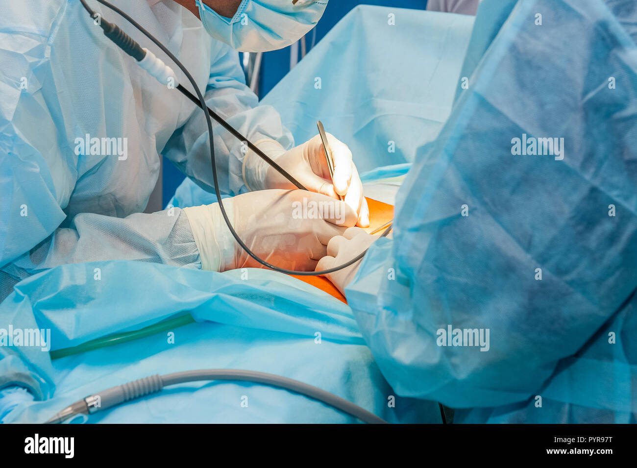 Peritoneal cavity hi-res stock photography and images - Alamy