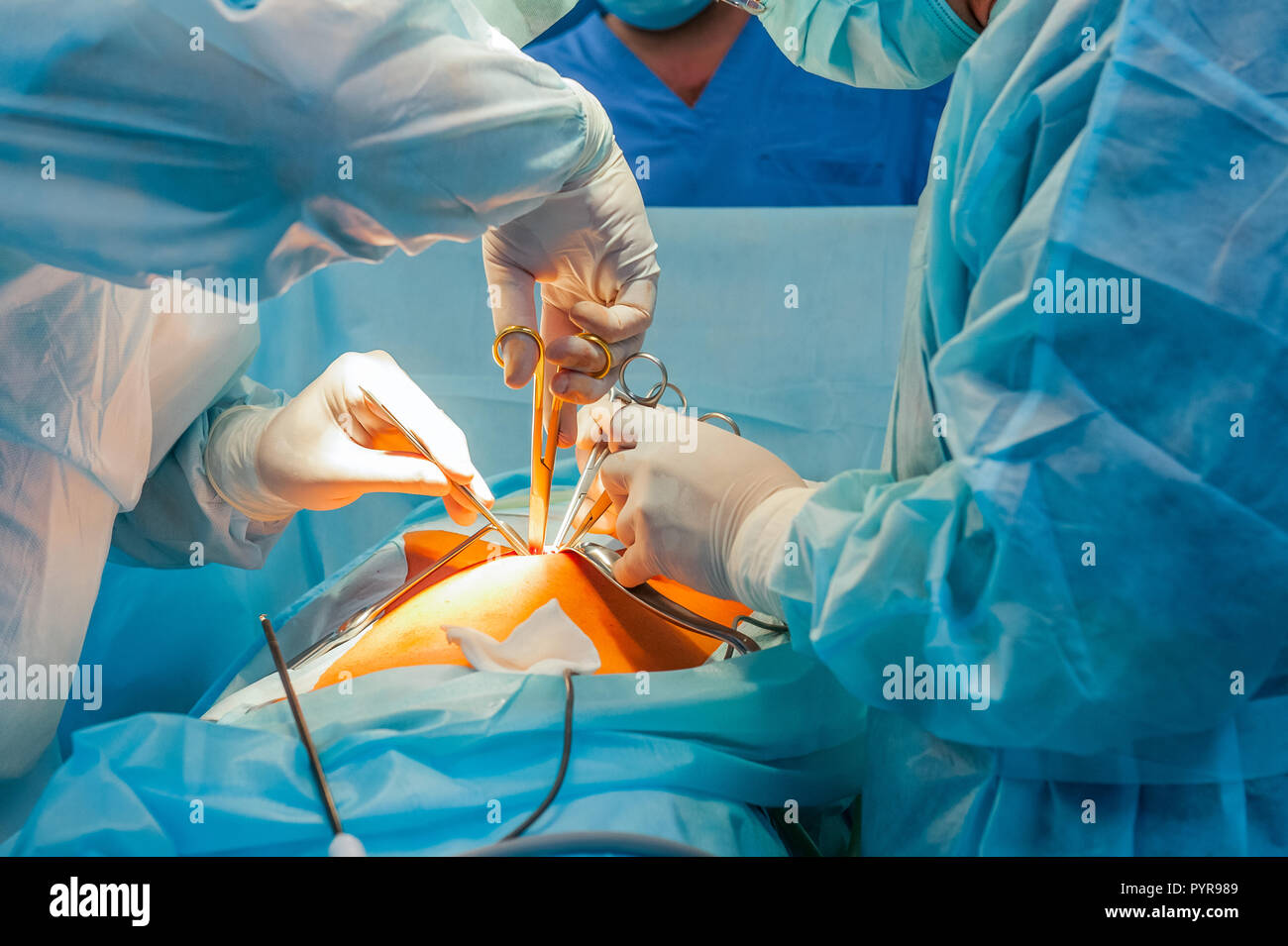 Peritoneal cavity hi-res stock photography and images - Alamy