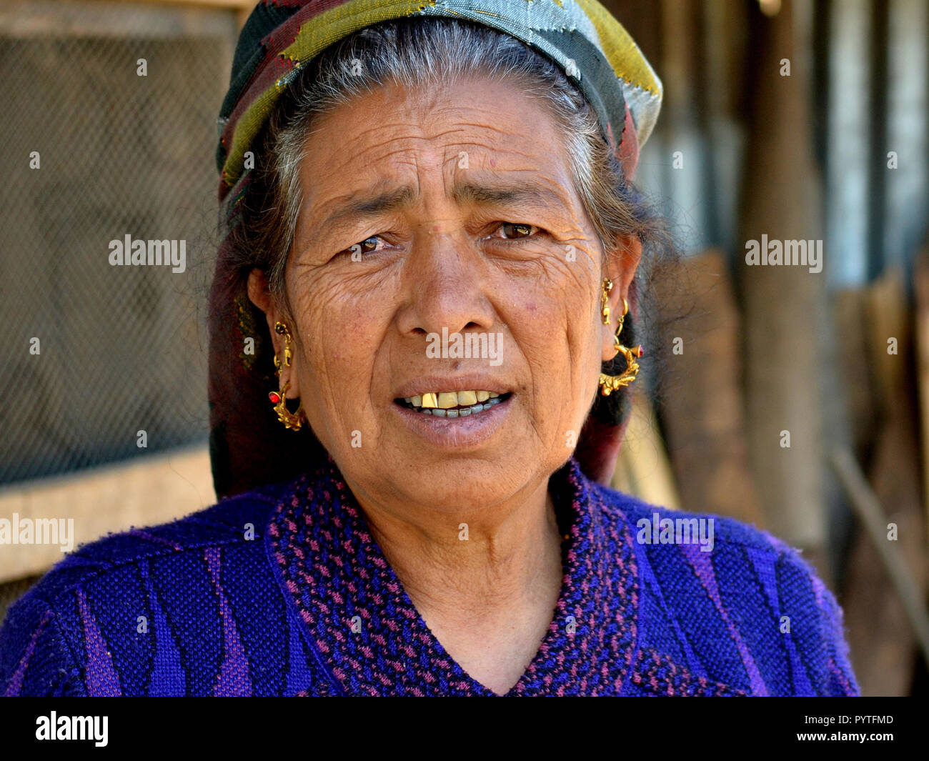 Gold tooth woman hi-res stock photography and images - Alamy
