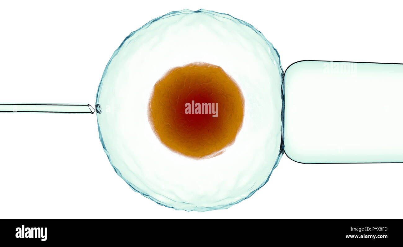 Artificial fertilization, assisted. Fertilized cell, ovum. Artificial ...