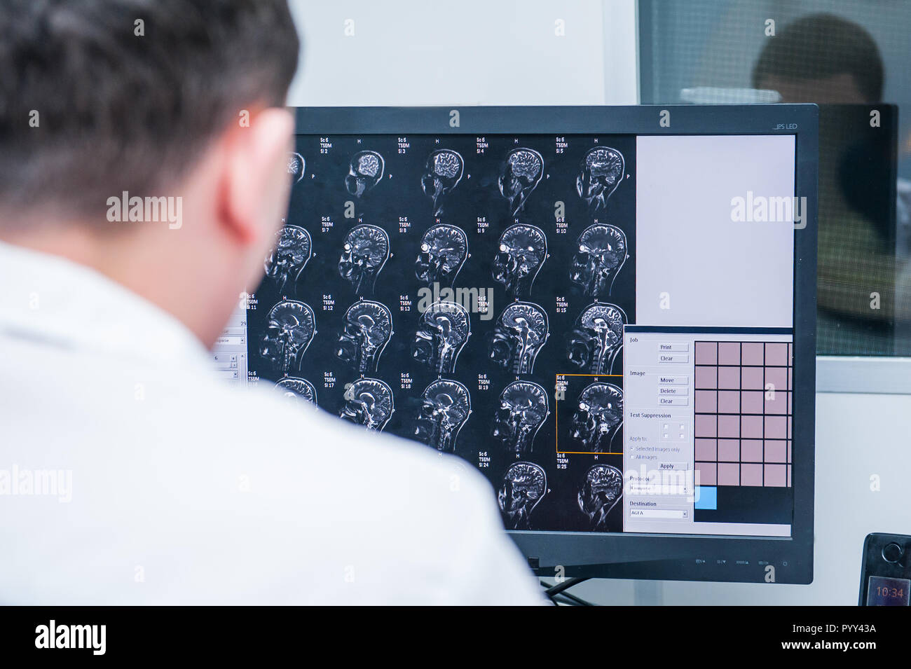 Doctors consider and discuss magnetic resonance image (MRI) of the ...