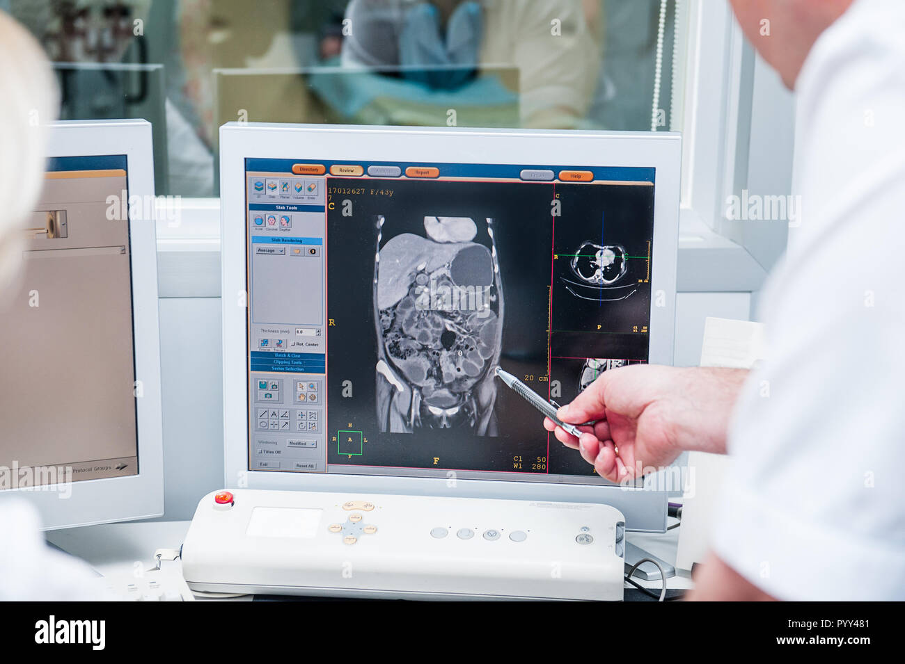 Doctors consider and discuss magnetic resonance image (MRI) of the ...