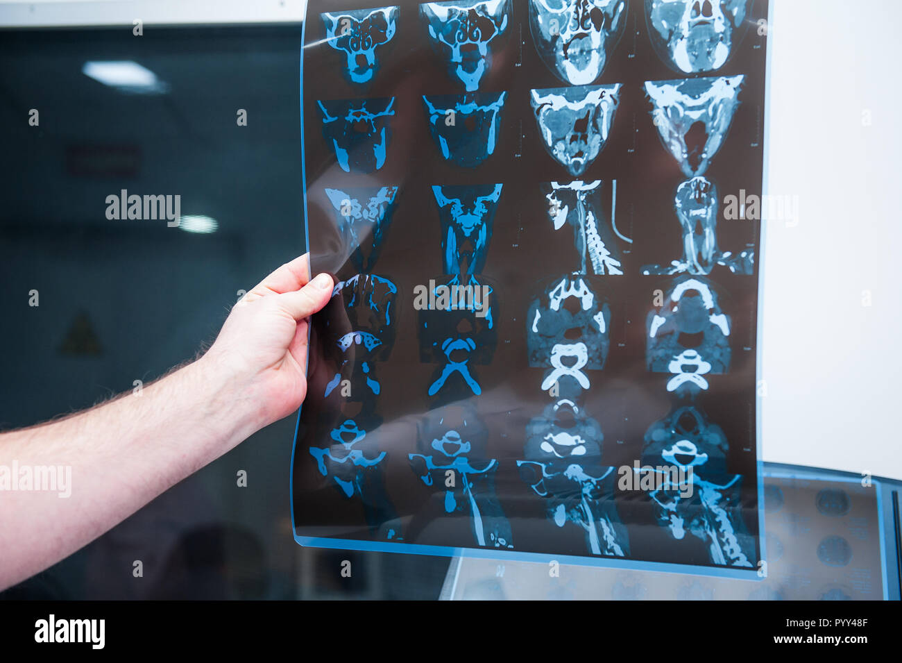 Doctor looking at magnetic resonance image (MRI) of the head. Back view ...